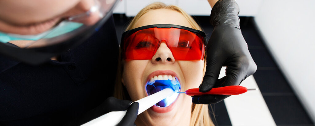 Bleaching - Teeth Whitening Methods - Can I Have Bleaching?